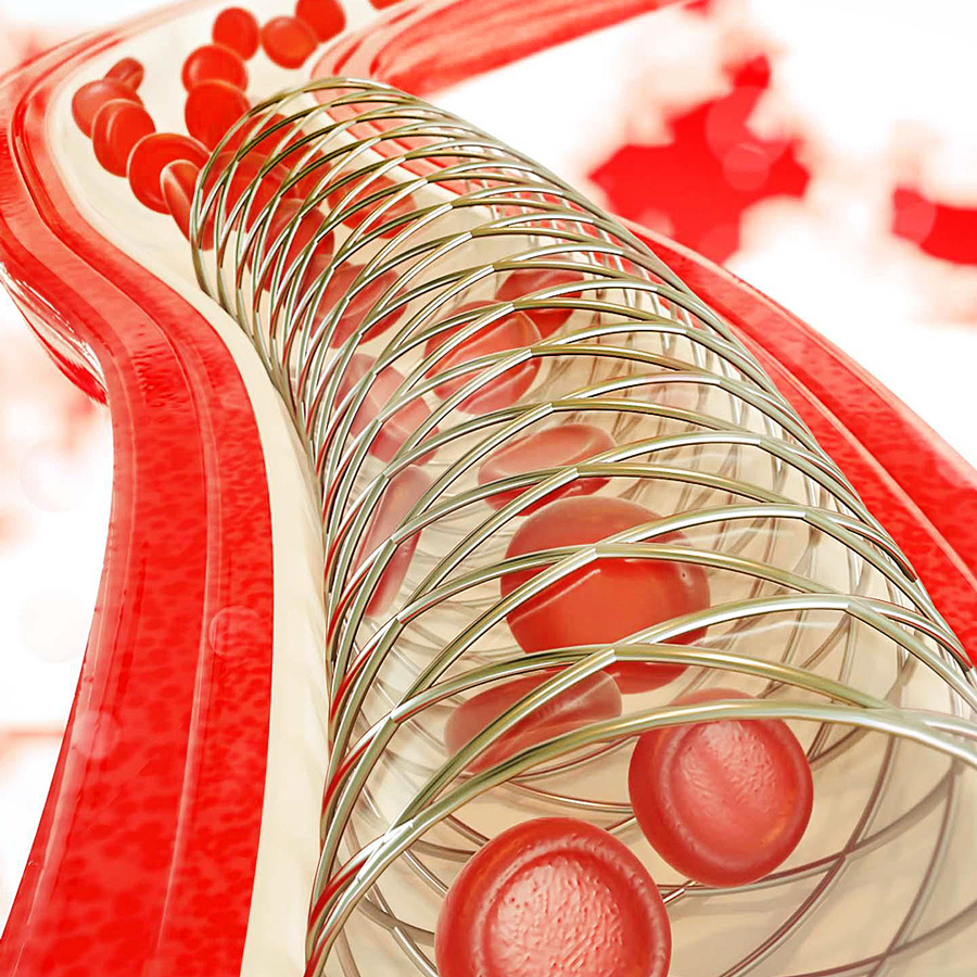 Tutoplast Pericardium