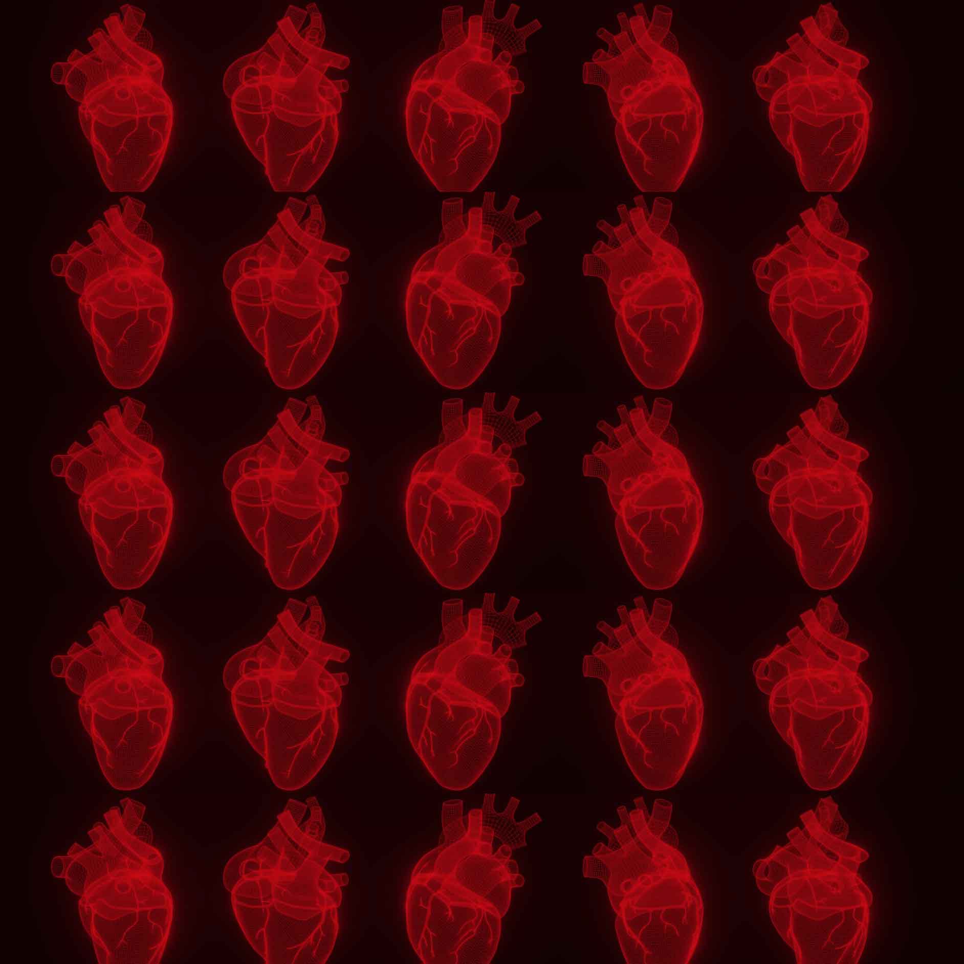 Αναίμακτη καρδιακή απεικόνιση - PERICARDIUM